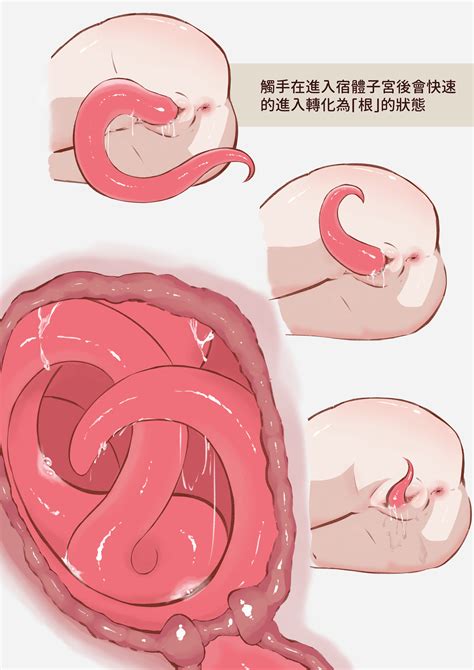 Rule 34 1girls Anus Ass Body Invasion Cervical Penetration Cervix