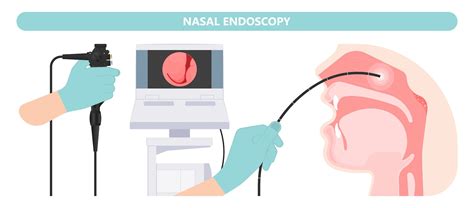 Ear Nose And Throat What Is A Nasal Endoscopy And Do You Need One