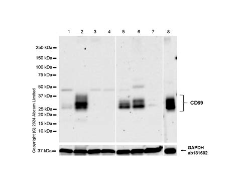 Anti Cd69 Antibody [rm1274] Ab322534