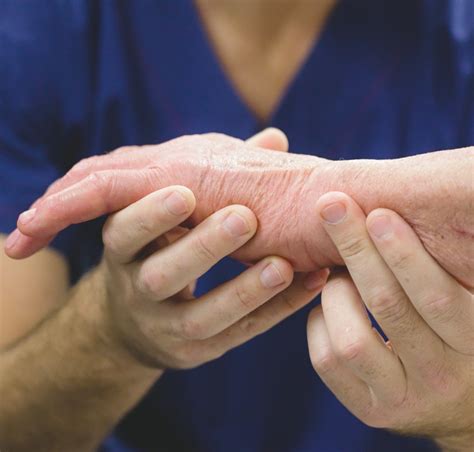 Trigger Finger Dr Oscar Brumby Rendell Orthopaedic Surgeon