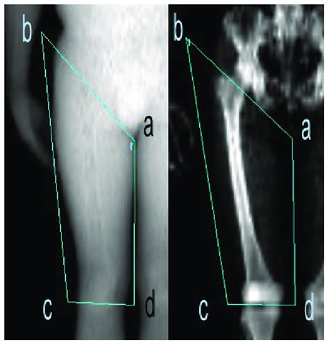 Example Of Dexa Scan Image Of Right Thigh A Four Sided Polygon Was Download Scientific Diagram