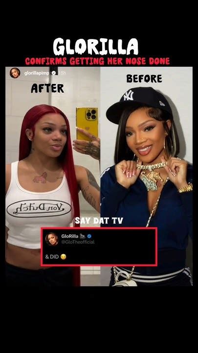 Glorilla Confirms She Underwent Nose Surgery Youtube