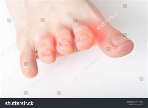 23 Interdigital Spaces 图片、库存照片和矢量图 Shutterstock