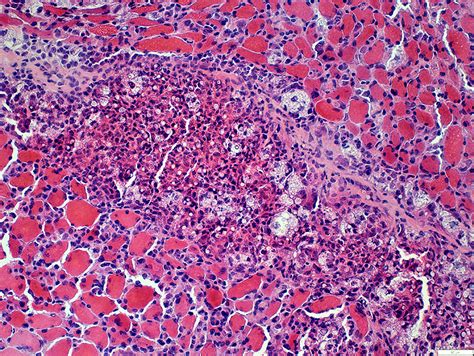 Cryptococcus