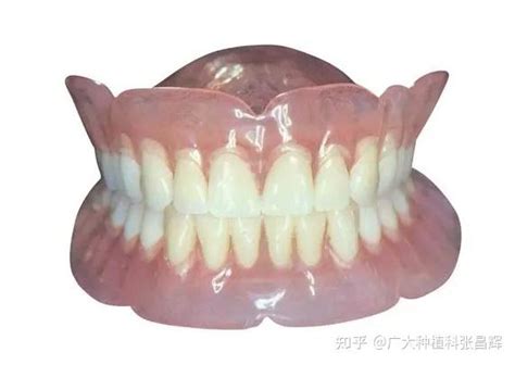 缺牙做哪种假牙最好假牙大全优缺点总有一款适合你 知乎