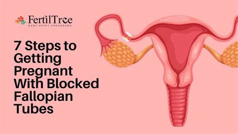 7 Steps To Getting Pregnant With Blocked Fallopian Tubes Fertile Tree