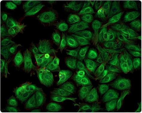 Total Internal Reflection Fluorescence Microscopy Market By 2026 Fluorescence Microscopy