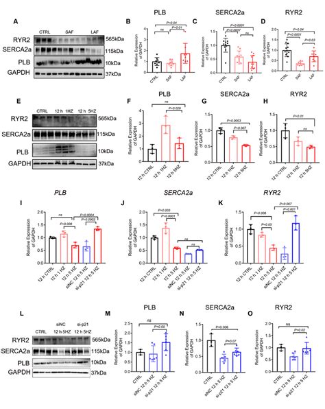 Tp Induced Senescence Partly Modulates Sarcoplasmic Reticulum Related