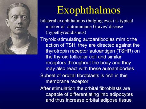 Biochemistry Of Thyroid Hormones презентация онлайн