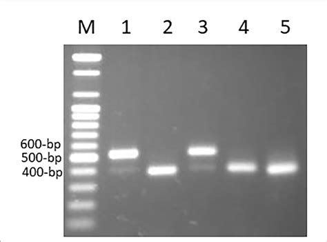 An Example Of Amplified Mite Fragments Observed In Five Download