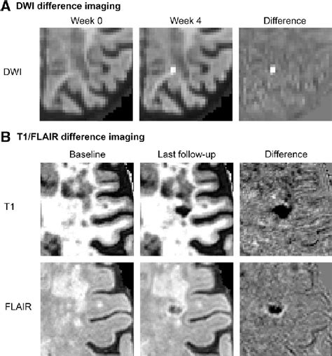 Incident Lesion Detection Using Difference Imaging A Download
