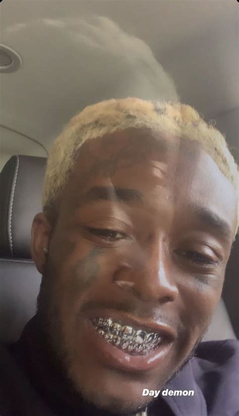 Manado Grillz Teeth Fav Celebs Celebrities Rapper Wallpaper Iphone Lil Uzi Vert Aesthetic