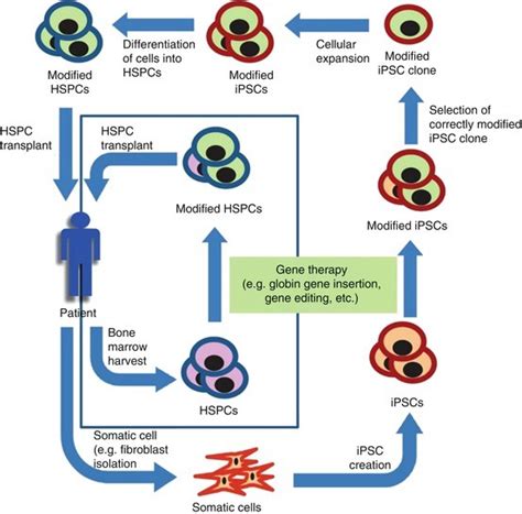 Gene Therapy The Path Toward Becoming A Realistic Cure For Sickle Cell