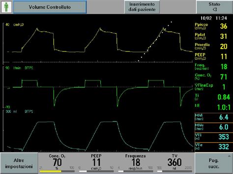 Peep Fio2 Pao2 E Compliance Nella Ards Come Sbrogliare La Matassa