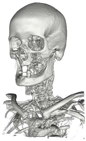 4 A Volume Rendering Using The Transfer Function From 2b B Download Scientific Diagram