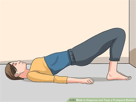 How To Diagnose And Treat A Prolapsed Bladder With Pictures