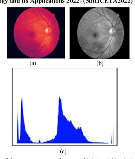 Figure 3 From Cataract Disease Detection Used Deep Convolution Neural Network Semantic Scholar