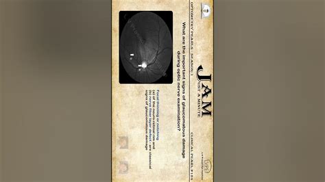 What Are The Important Signs Of Glaucomatous Damage During Optic Nerve