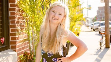 At 24 This Model With Down Syndrome Has Appeared On The Today Show And
