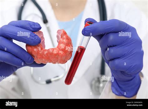 Endocrinologist Showing Thyroid Gland Model And Blood Sample In Test