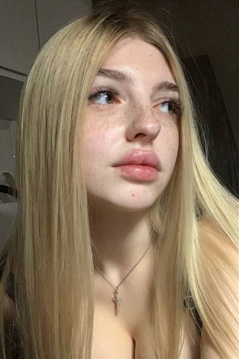 Took My Freckles Outside Today R Freckledgirls