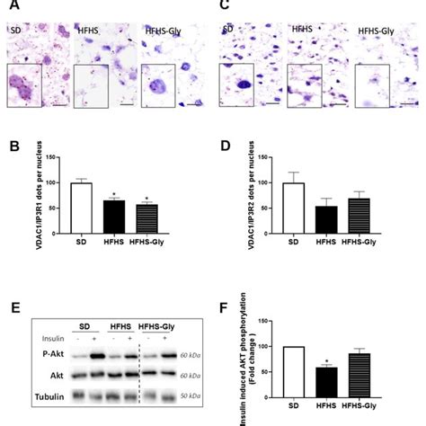 The Impact Of Obesogenic Diet And Glycine On Hepatic Mam Integrity And