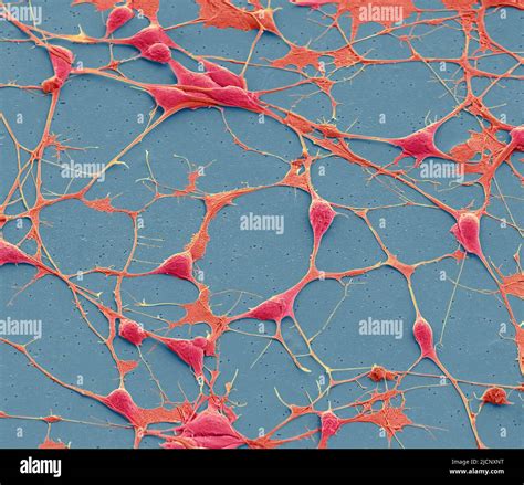 Pluripotent Derived Neurones Coloured Scanning Electron Micrograph Sem Human Neurons