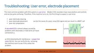 Cm Ecg Recorder Pppptx