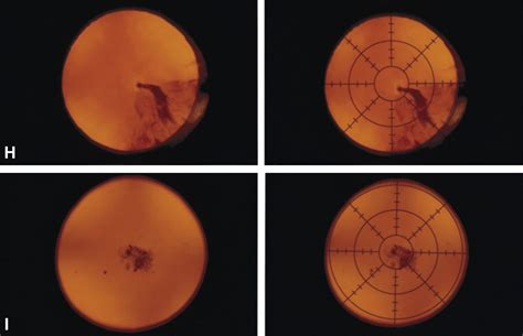 Deeplensnet Deep Learning Automated Diagnosis And Quantitative