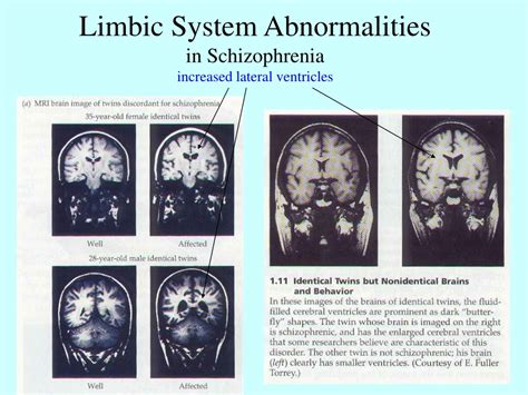 Ppt Neuroanatomy Powerpoint Presentation Free Download Id9654286