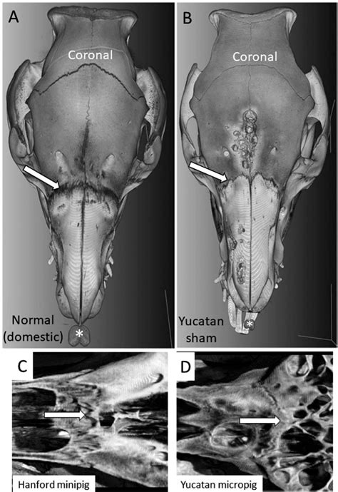 Sutural Ligament Semantic Scholar