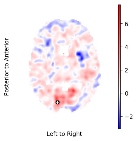 Subject Analysis Inference At A Single Coordinate — Fmristats 010