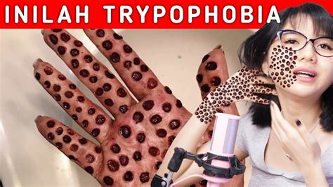Apa Itu Trypophobia Ternyata Begini Rasanya Youtube