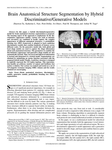 Pdf Brain Anatomical Structure Segmentation By Hybrid Discriminative