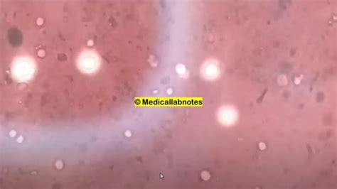Cryptococcus Introduction Morphology Pathogenicity Lab Diag