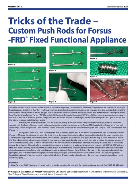 Pdf Custom Push Rods For Forsus Frd ® Fixed Functional Appliance