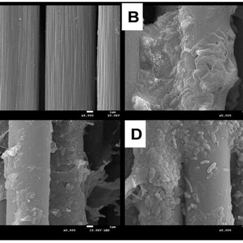 comparative sem morphological analysis of the differences in the anodic