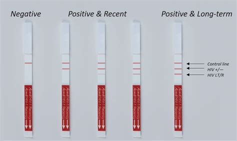 Asanté HIV Rapid Recency Sedia Biosciences