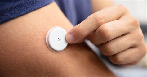 Skin Assessment And Ongoing Skincare With Adhesive Diabetes Management