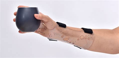 About Cassit Innovative Splints And Casts