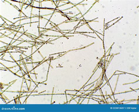 Cyanobacteria Microcystis By Microscope Colony Of Unicellular Microscopic Algae Object Of