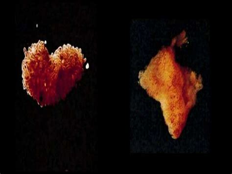 Approach To Malabsorption Syndrome Pptx