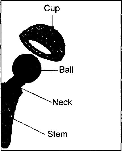 Figure 2 From Optimal Design Of Femoral Hip Prosthesis Using Topology Optimisation To Reduce