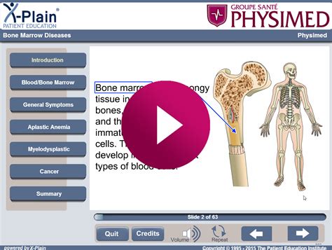Maladies De La Moelle Osseuse Groupe Santé Physimed