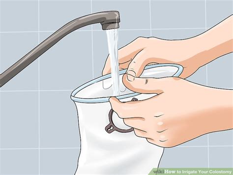 How To Irrigate Your Colostomy 14 Steps With Pictures WikiHow