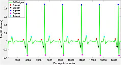 Typical Lead Ii Ecg Signal With The Detected P Q R S T Fiducial Download Scientific Diagram