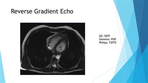 Gradient Echo Pulse Sequences Hjnpptx