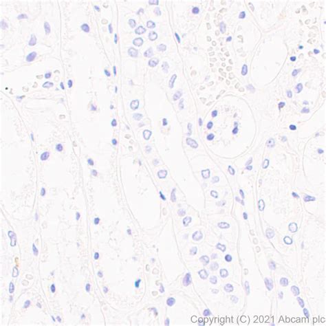 Anti Ss18 Ssx Fusion Protein Antibody Epr24159 81 Ab254406 Abcam