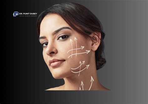 Midface Lift Surgery In Delhi Midface Lift Surgery Cost