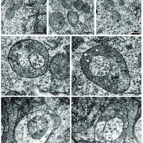 Ultrastructure Of The Mitochondria Of The Cytoplasm Of The Antipodal